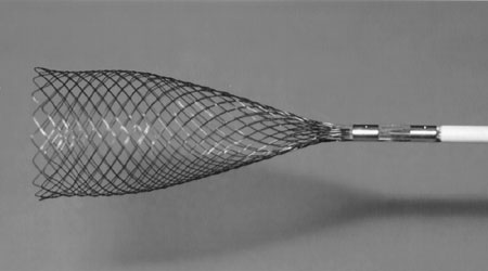Percutaneous Venous Thrombectomy Using the Arrow-Trerotola Percutaneous ...