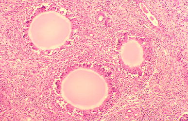 In Vivo Evaluation of a New Embolic Spherical Particle (HepaSphere) in ...