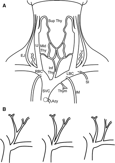 The Essentials of Parathyroid Hormone Venous Sampling | SpringerLink