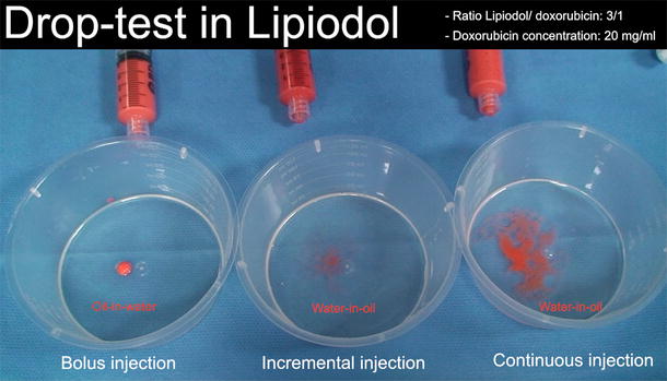 Parameters for Stable Water-in-Oil Lipiodol Emulsion for Liver Trans ...