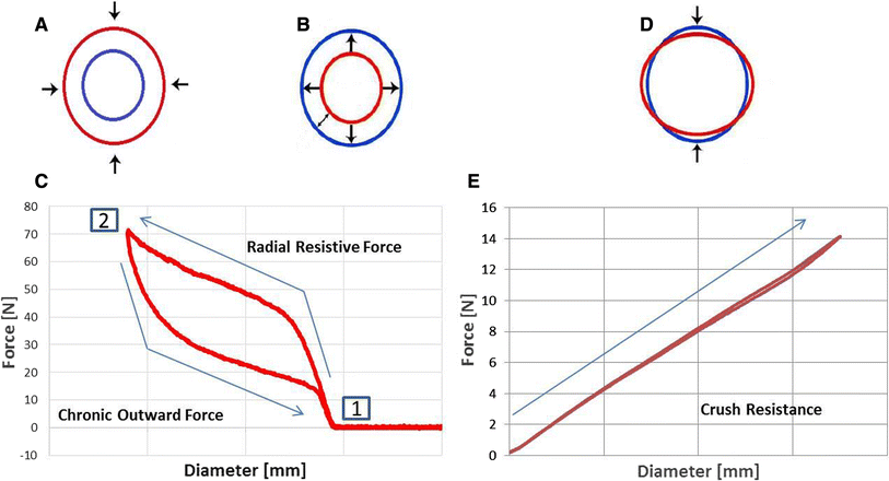 Physical Properties of Venous Stents: An Experimental Comparison ...