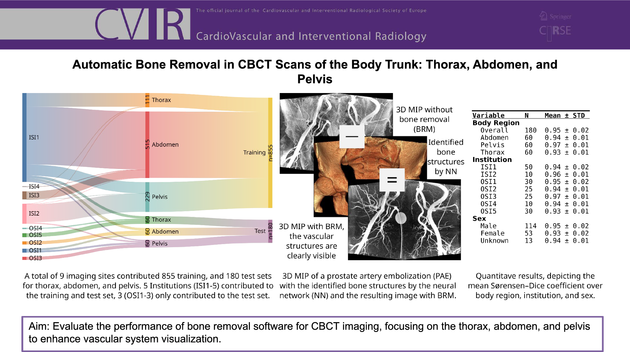 Digital Volume Tomography | Automatic Bone Removal in CBCT Scans of the ...