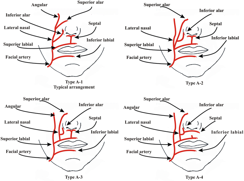 A detailed observation of variations of the facial artery, with ...