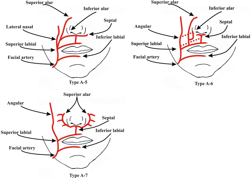 A detailed observation of variations of the facial artery, with ...