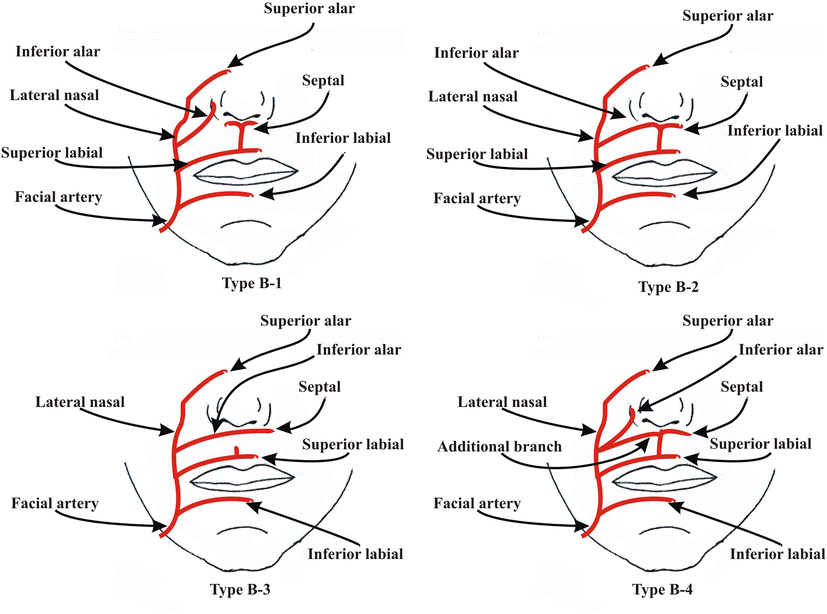 A detailed observation of variations of the facial artery, with ...