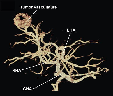 Ramification of Glisson’s sheath peripheral branches and clinical ...
