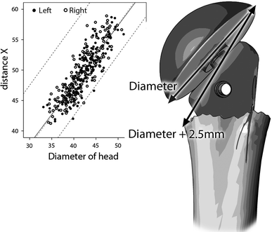 Medial calcar of proximal humeral fracture as landmark in restoration ...