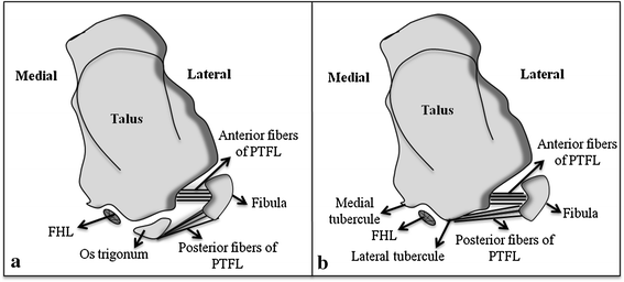 The anatomic variations of the posterior talofibular ligament ...