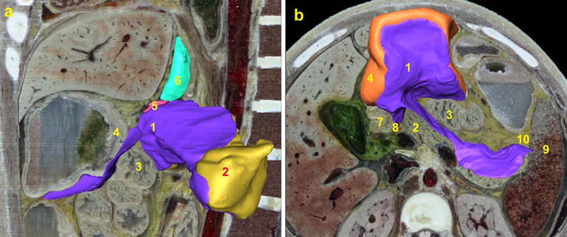Visualization of the omental bursa and its spatial relationships to ...
