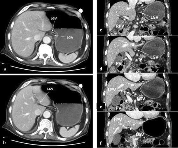 CT imaging-based determination and classification of anatomic ...