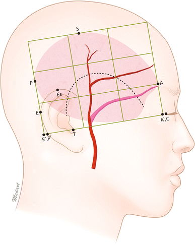 Anatomical recommendations for safe botulinum toxin injection into ...