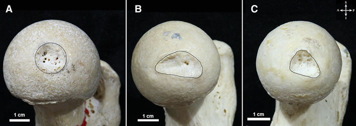 The morphology and morphometry of the fovea capitis femoris | SpringerLink