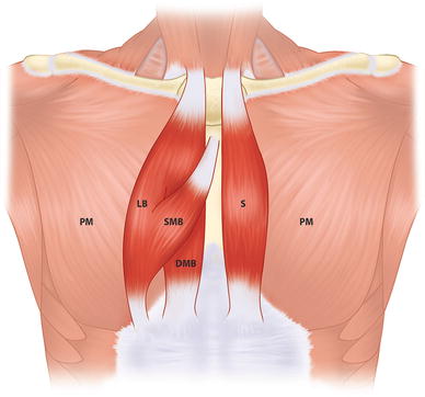 A previously unclassified variant of sternalis muscle | SpringerLink
