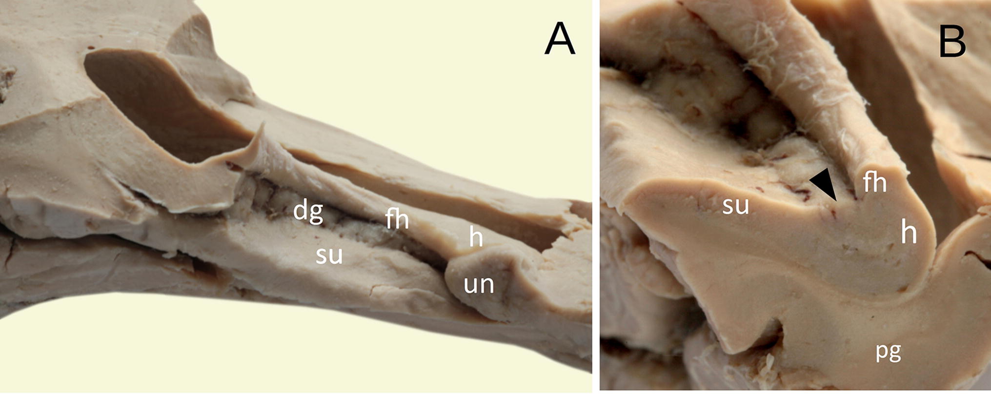 Anatomical variations of the dentate gyrus in normal adult brain ...