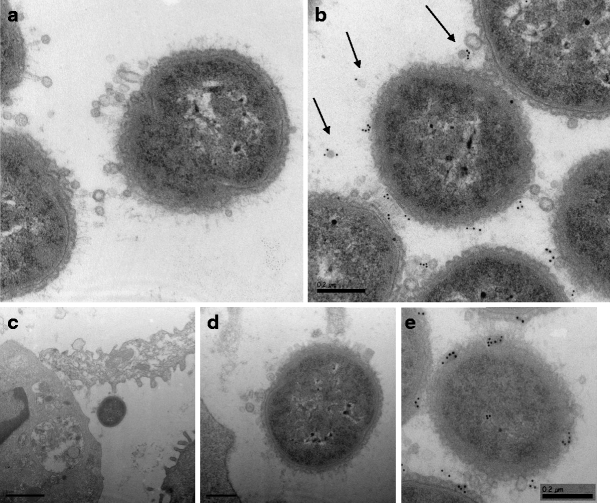 Bacterial outer membrane vesicles in disease and preventive medicine ...