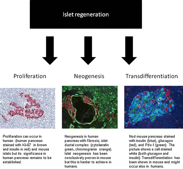 Beta cell regeneration in human pancreas | SpringerLink