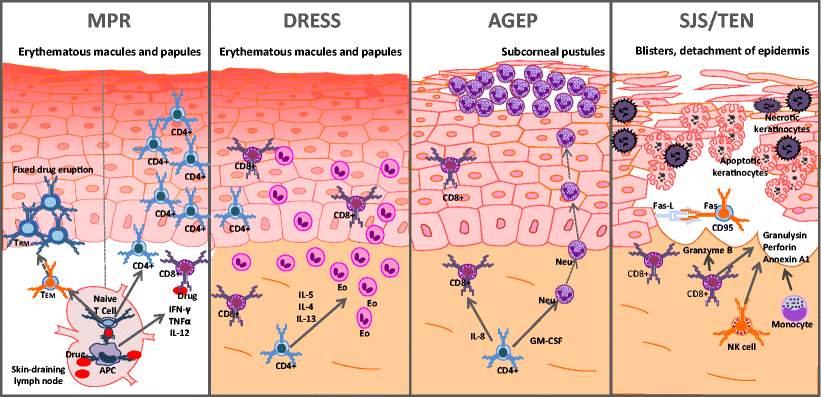 Adverse cutaneous drug eruptions: current understanding | SpringerLink