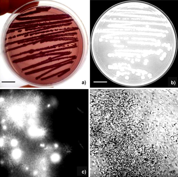 Cellulose Biosynthesis by the Beta-Proteobacterium, Chromobacterium ...
