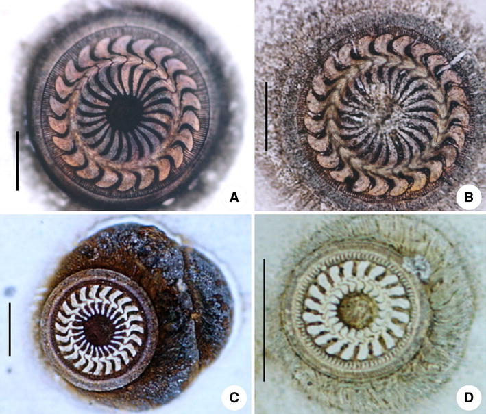 Phylogenetic Analyses of Trichodinids (Ciliophora, Oligohymenophora ...