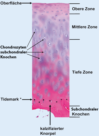 Arthrose | SpringerLink