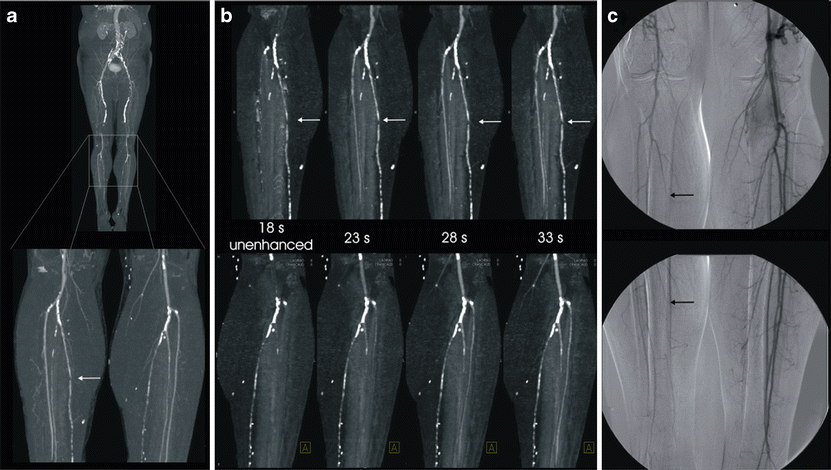 Diagnostic value of time-resolved CT angiography for the lower leg ...