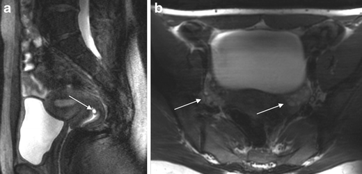 Seven-Tesla MRI of the female pelvis | SpringerLink