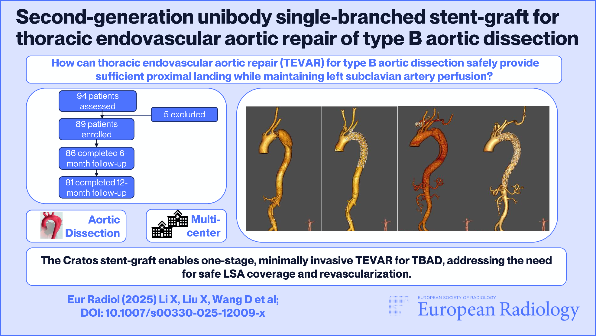 Aortic Dissection | Second-generation unibody single-branched stent ...