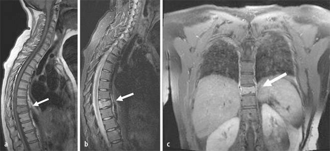 Lebensretter Nelson | SpringerLink