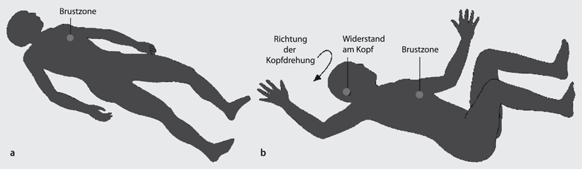 Das Vojta-Prinzip | SpringerLink