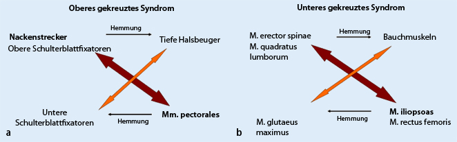 Das „Janda-Konzept“ | SpringerLink