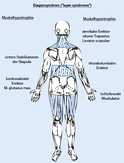 Das „Janda-Konzept“ | SpringerLink