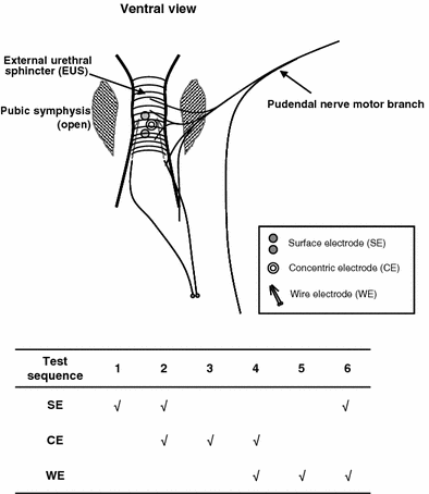 Quantitative evaluation of electrodes for external urethral sphincter ...