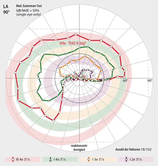 Konventionelle Perimetrie | SpringerLink