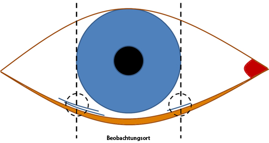 Praktische Tipps und Vorgehensweise bei der Anpassung weicher ...