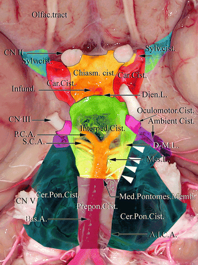 Microsurgical study of the interpeduncular cistern and its ...