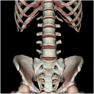Lumbar ribs: a comprehensive review | SpringerLink