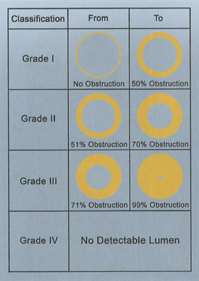Pediatric airway surgery | SpringerLink