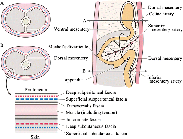 Laparoscopic-assisted low anterior resection of the rectum—a review of ...