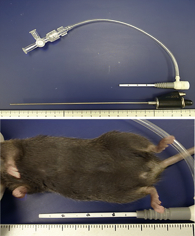 Colonoscopy as a tool for evaluating colorectal tumor development in a ...
