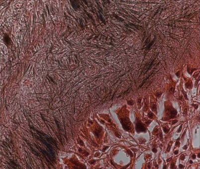 Die Gicht als Systemerkrankung | SpringerLink