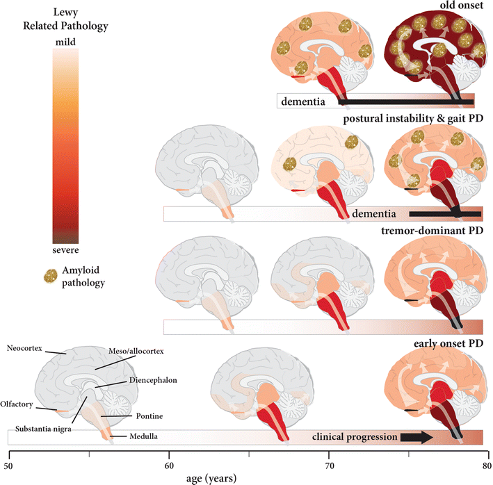 Neuropathology underlying clinical variability in patients with ...
