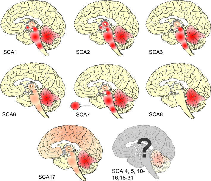 Brain pathology of spinocerebellar ataxias | SpringerLink
