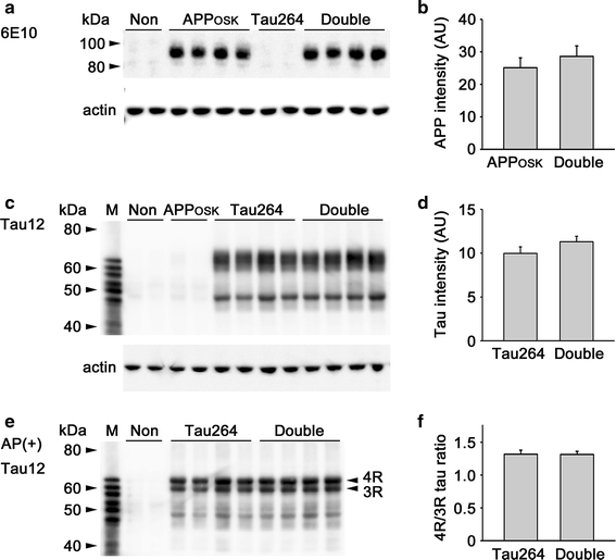 Neurofibrillary tangle formation by introducing wild-type human tau ...