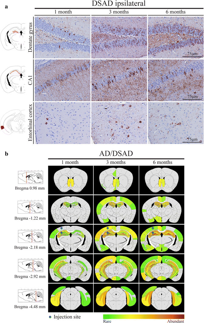 Differential induction and spread of tau pathology in young PS19 tau ...