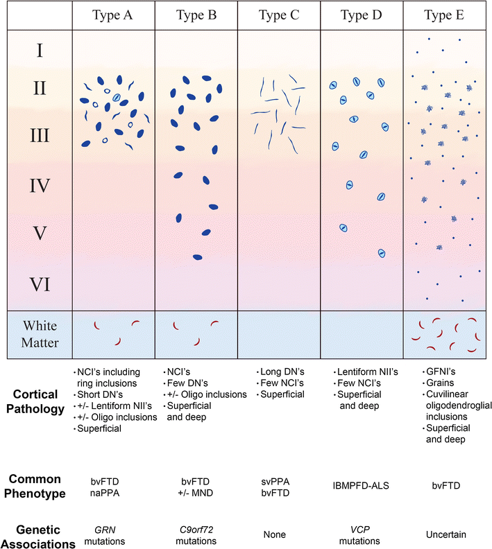 Expansion of the classification of FTLD-TDP: distinct pathology ...
