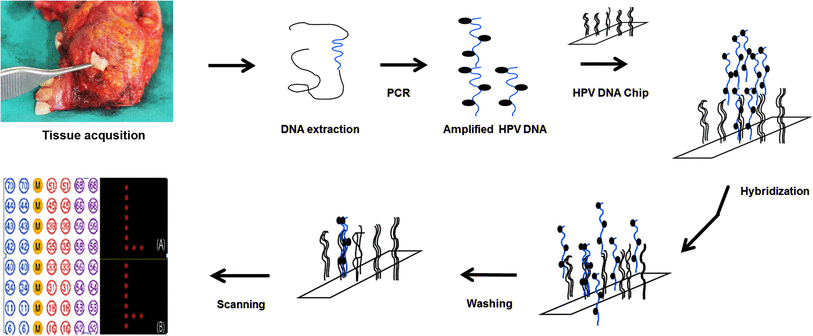 Identification of human papillomavirus (HPV) subtype in oral cancer ...