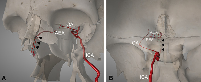 Septal branches of the anterior ethmoidal artery: anatomical ...
