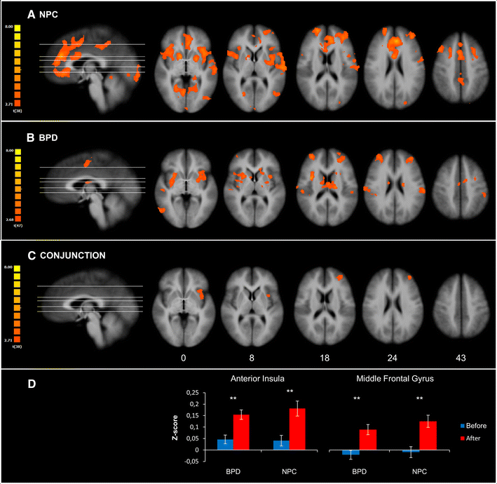 Deficient amygdala–prefrontal intrinsic connectivity after effortful ...