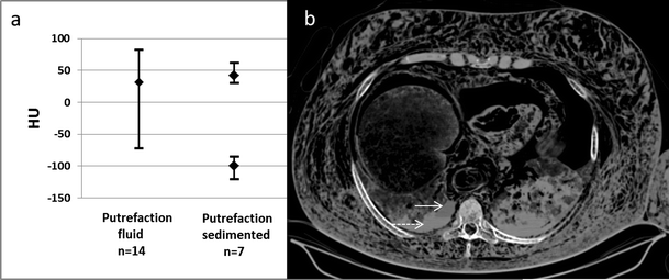 Characterization and differentiation of body fluids, putrefaction fluid ...