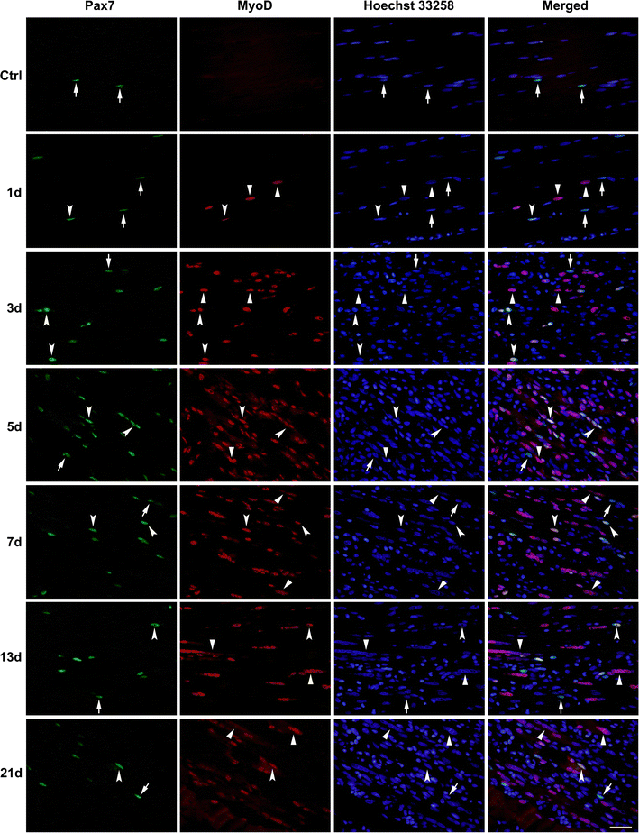 Detection of satellite cells during skeletal muscle wound healing in ...
